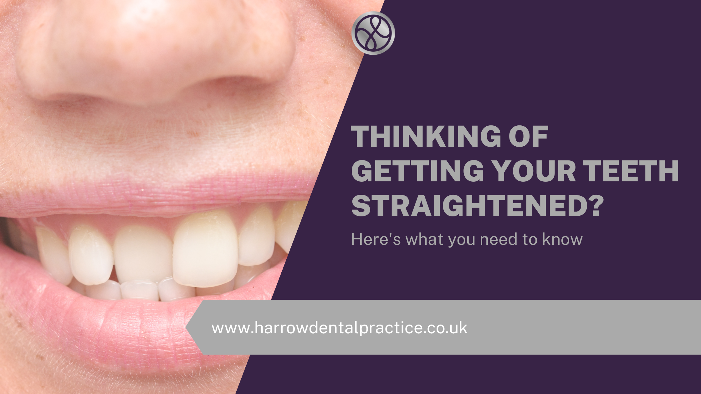 Thinking Of Getting Your Teeth Straightened? Here's What You Need To ...